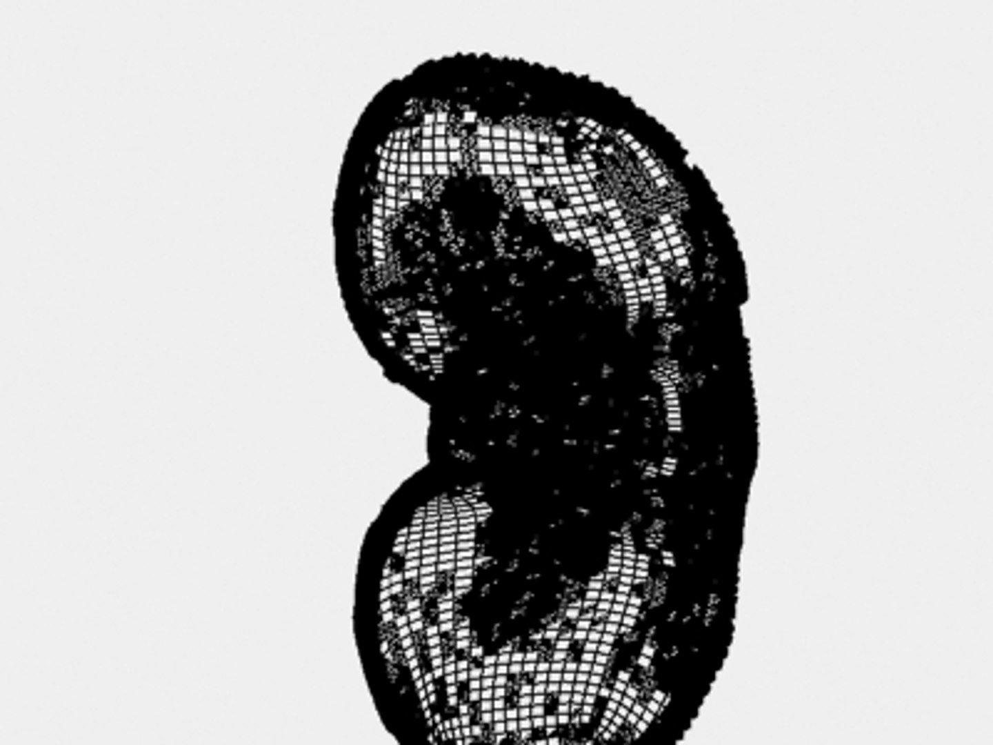 3d Realistic Kidney