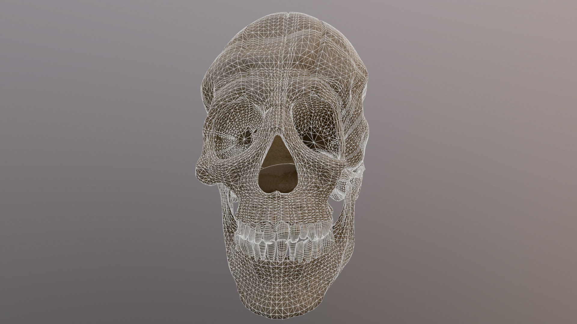 Damaged Skull Model - TurboSquid 1720615