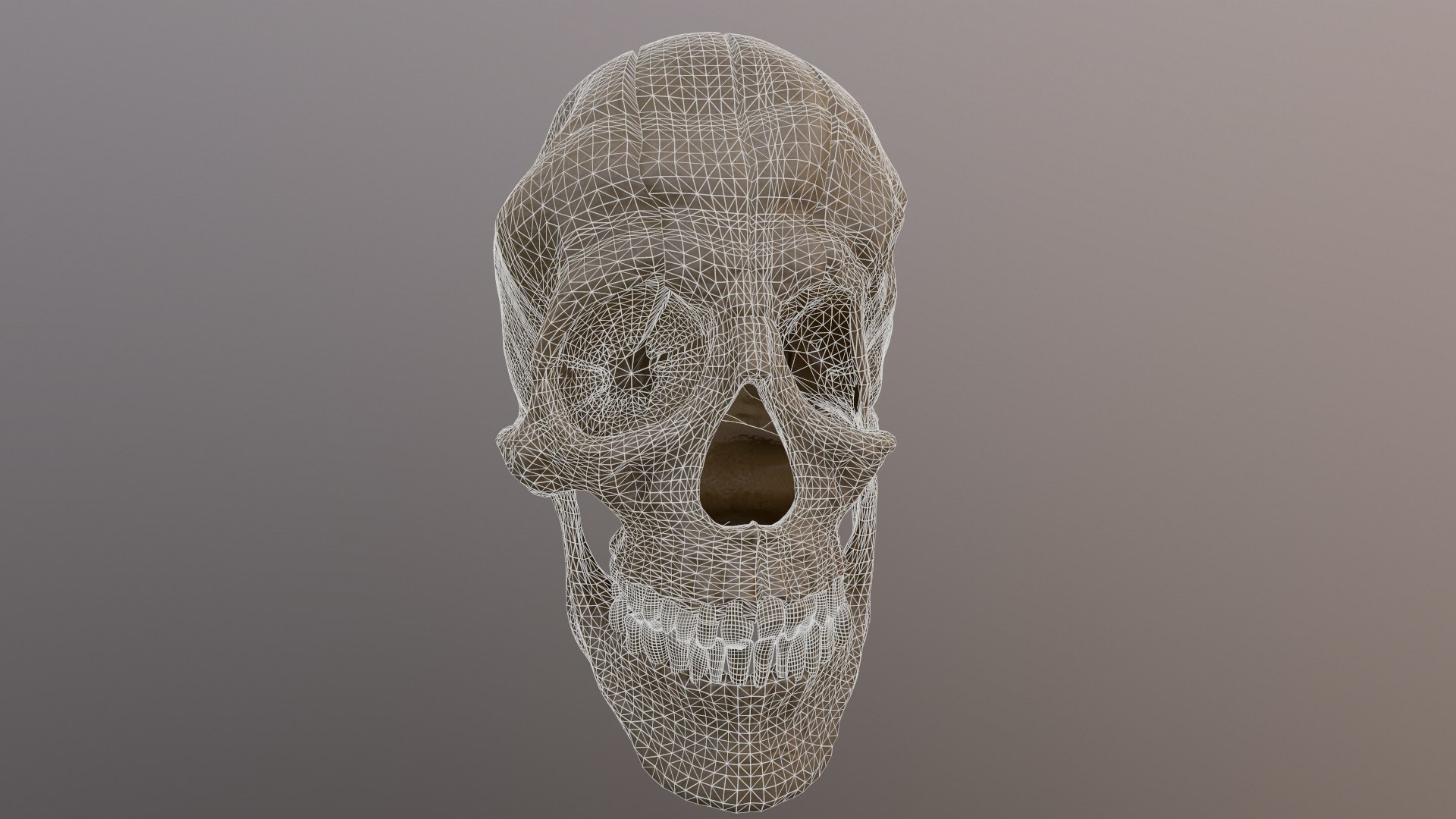 Damaged Skull Model - TurboSquid 1720615