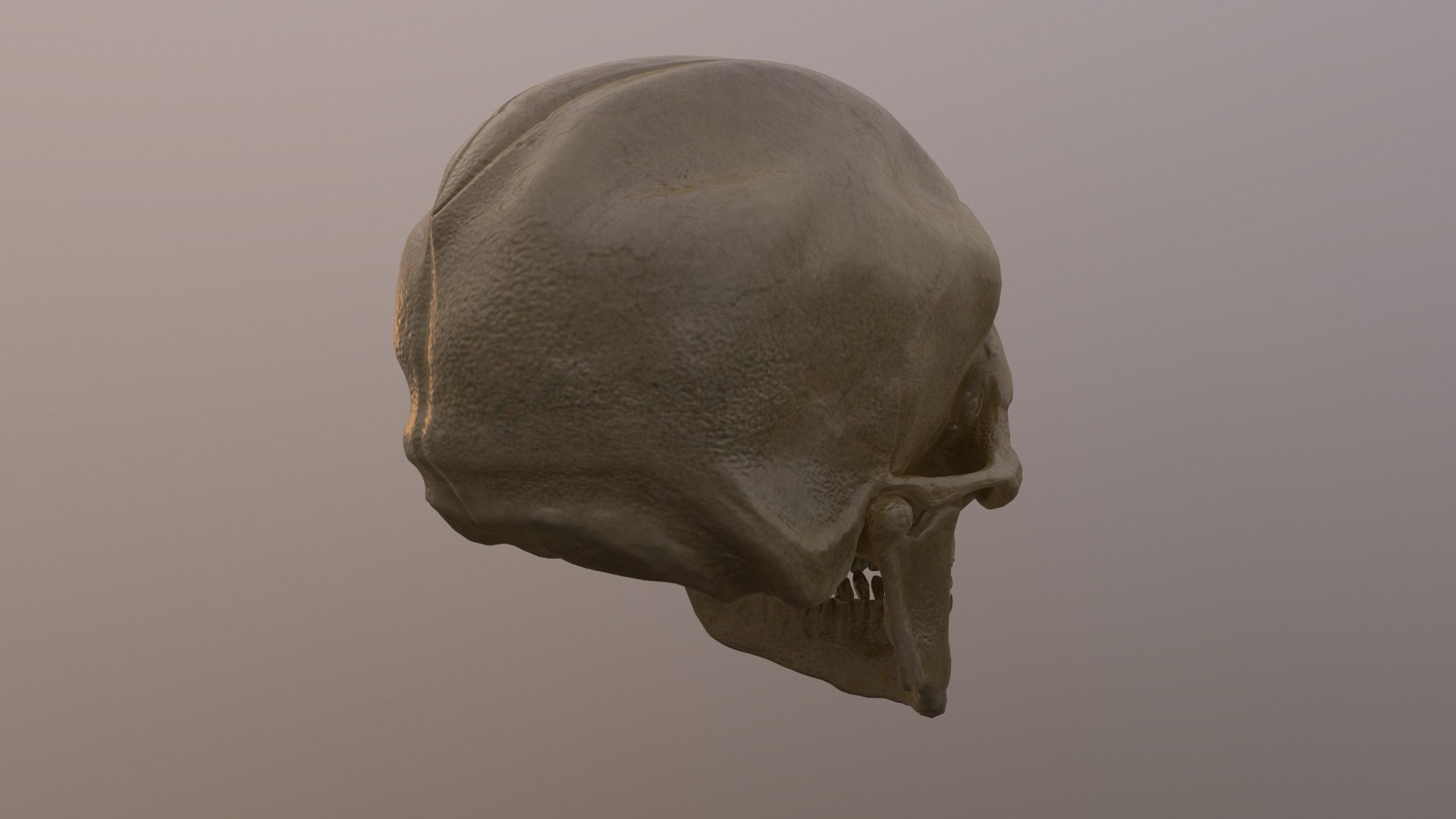 Damaged Skull Model - TurboSquid 1720615