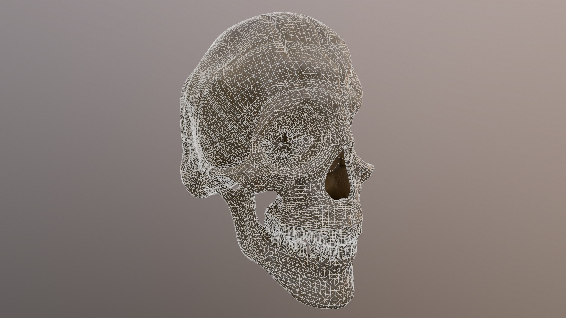 Damaged Skull Model - TurboSquid 1720615
