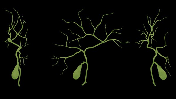 modelo 3d Anatomía de la vesícula biliar - TurboSquid 2035071