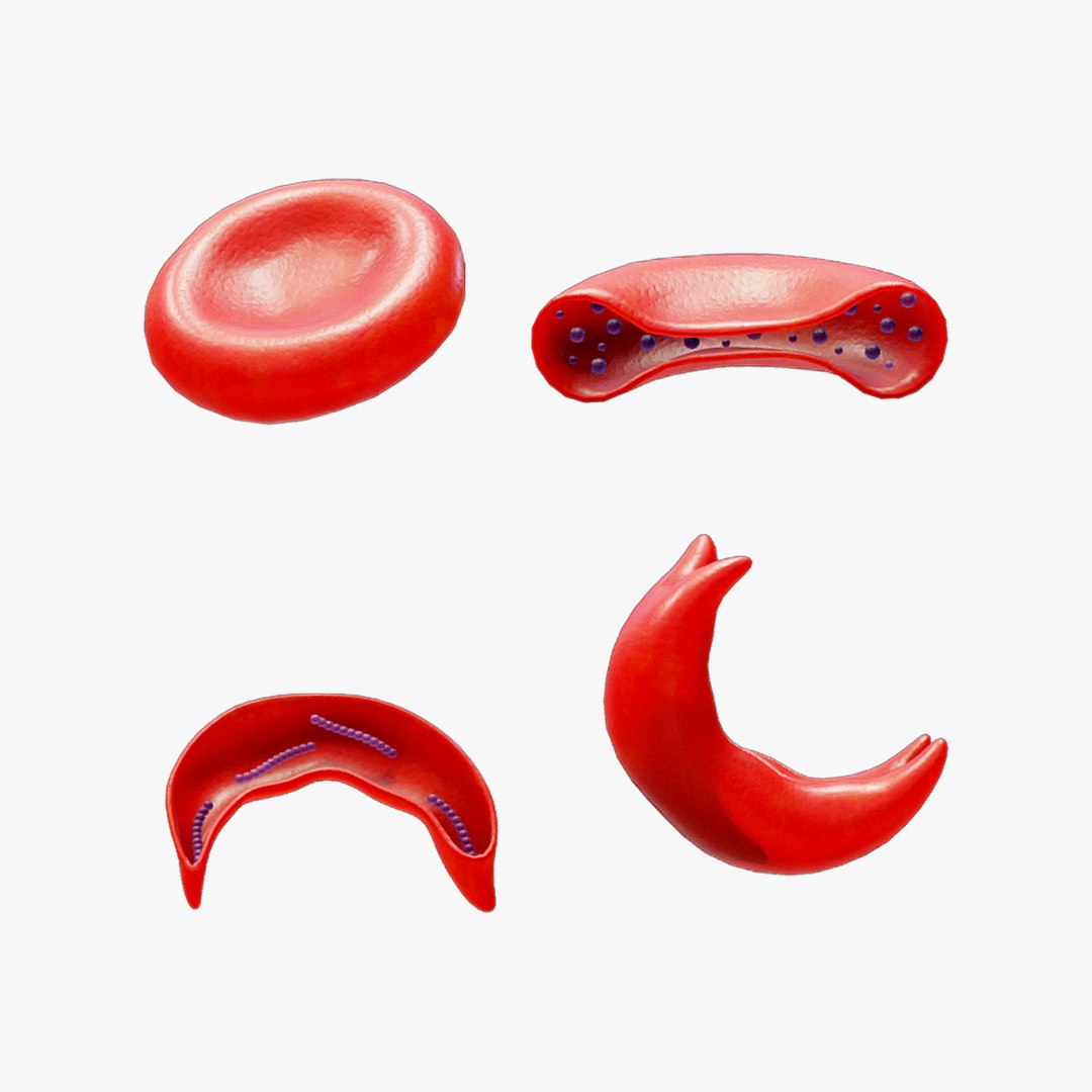 3D model Cross Section of Normal vs Sickle Red Blood Cell - TurboSquid ...