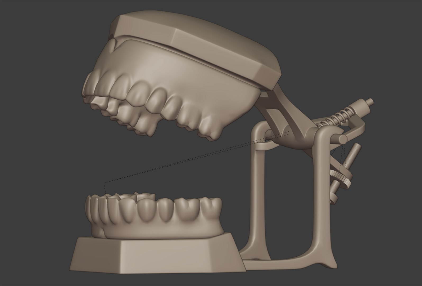 3D Dental Prosthesis Articulator - TurboSquid 1633148