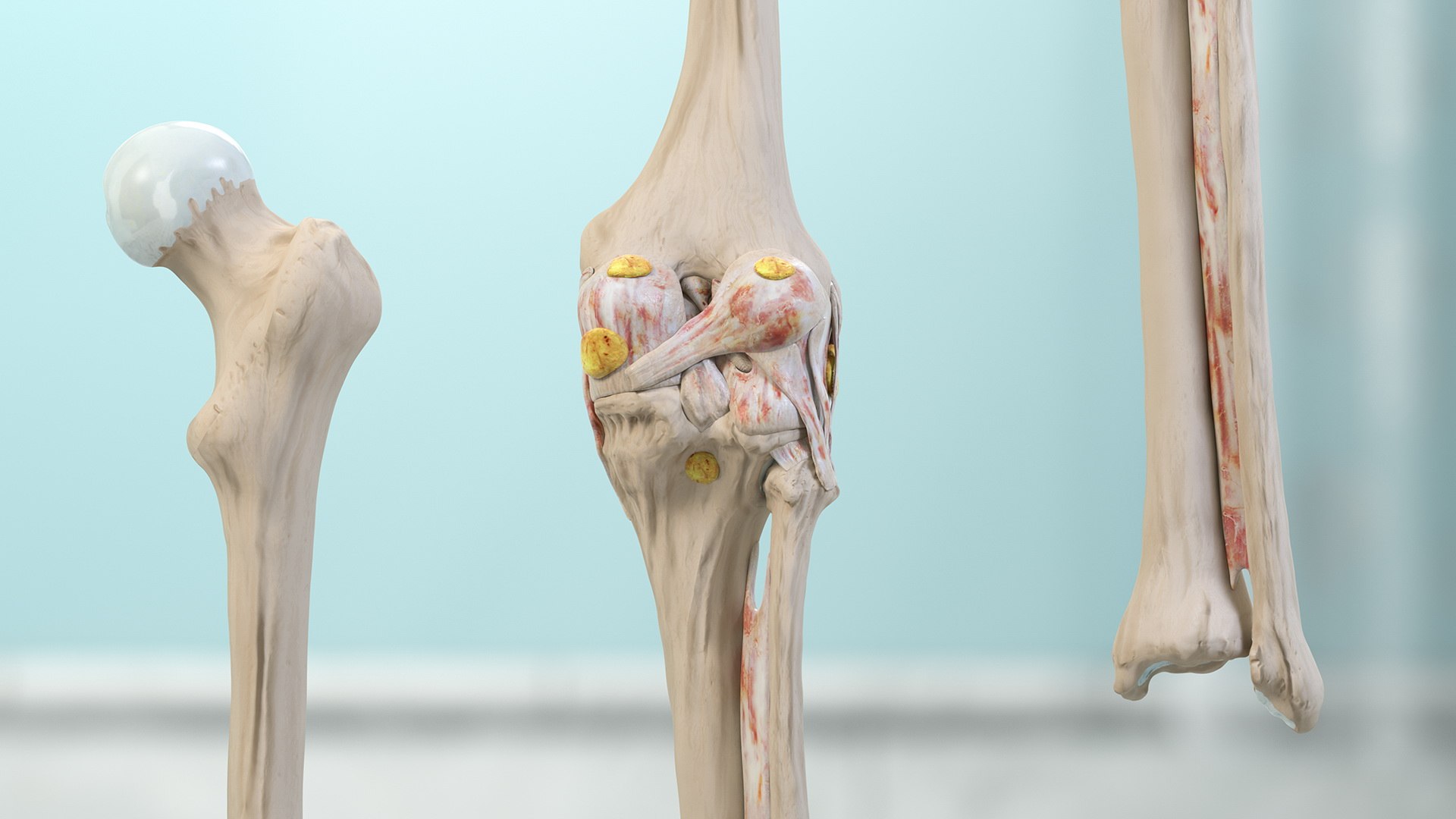 Human Knee Bones 3D Model - TurboSquid 1619037