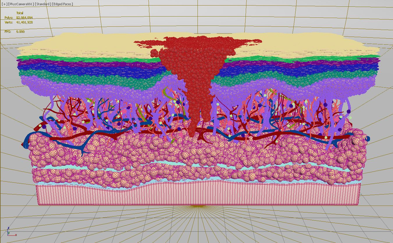 3D skin cancer cells - TurboSquid 1412955