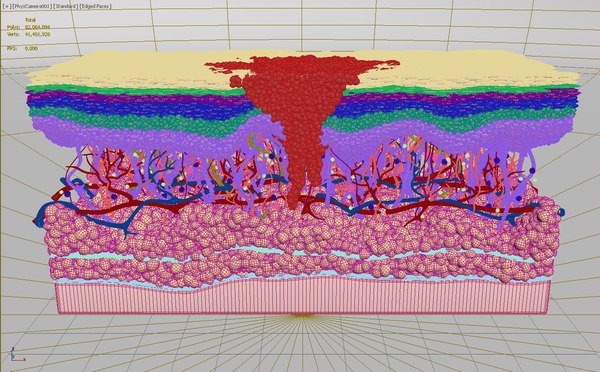 3D skin cancer cells - TurboSquid 1412955