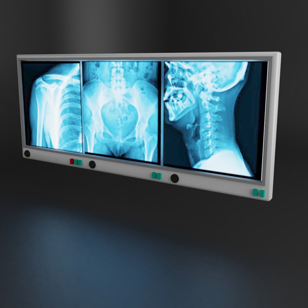 Medical Equipment 3D Model - TurboSquid 1539226