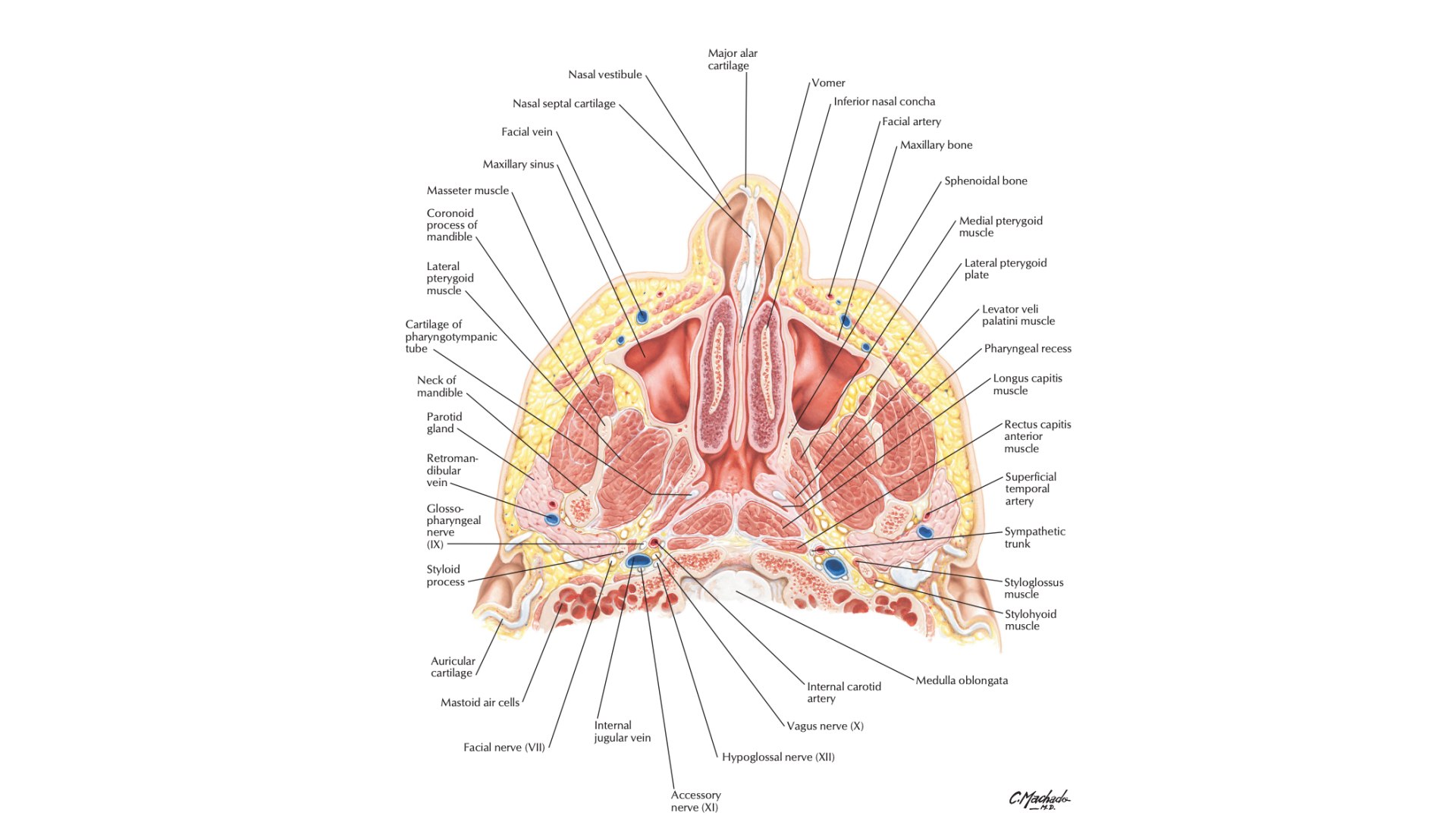 3D Model Nose And Maxillary Sinus Transverse Section - TurboSquid 1966929