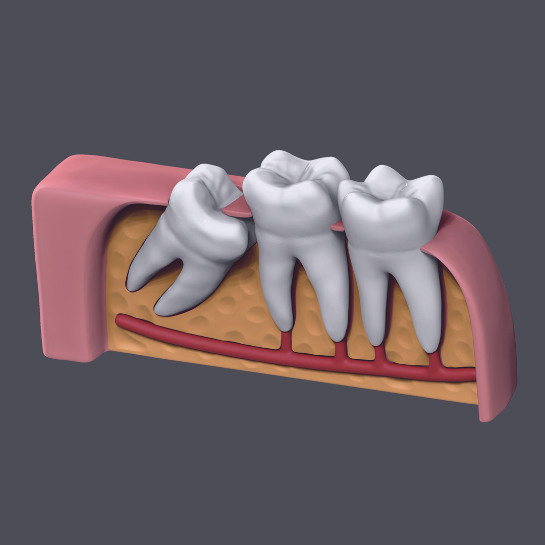 3D wisdom impaction tooth - TurboSquid 1471461