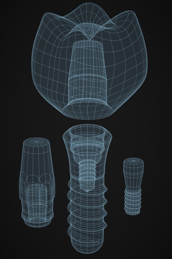 Dental Implant 3D Model - TurboSquid 1407952