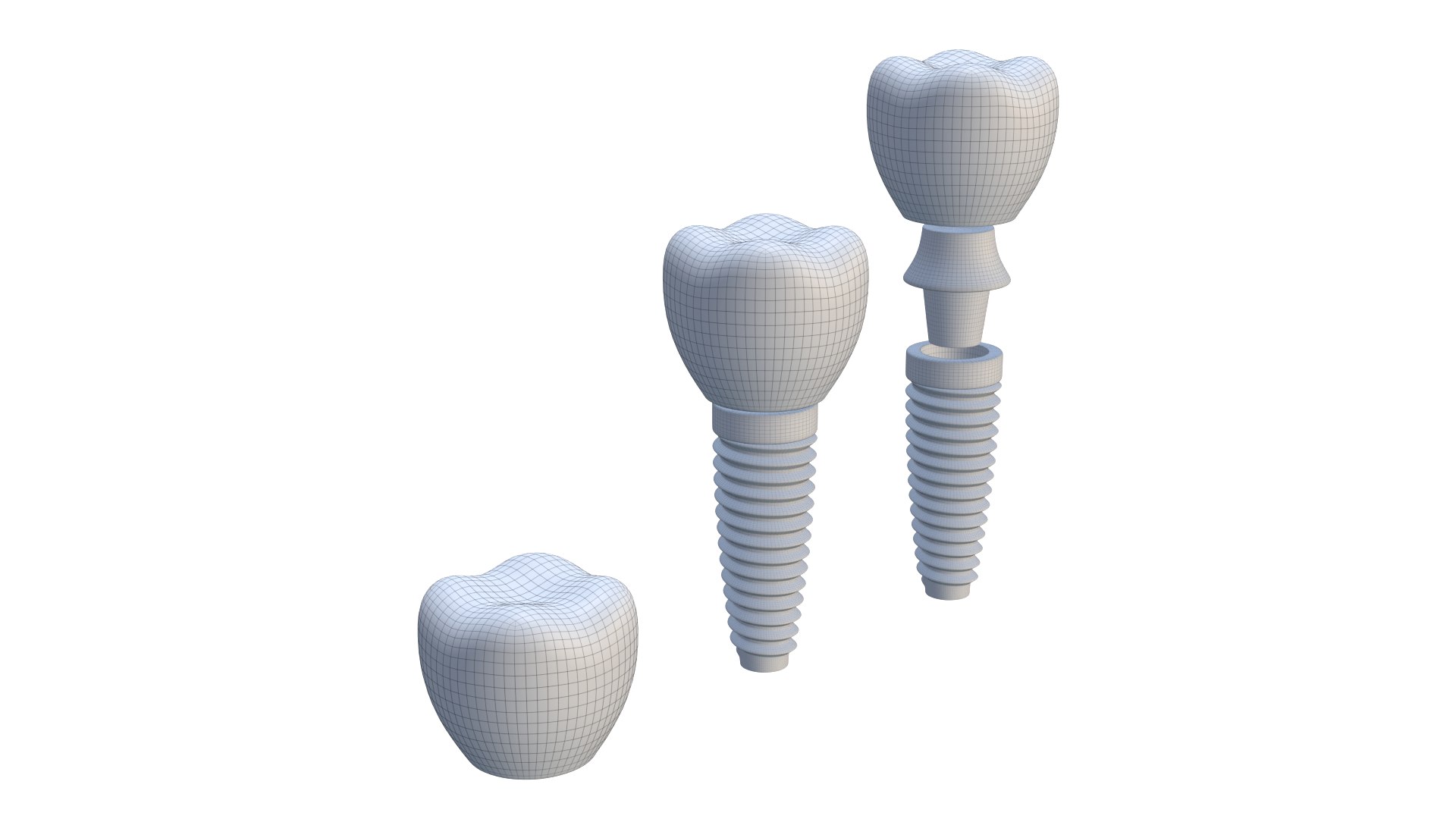 3D Tooth Implant Model - TurboSquid 2377546