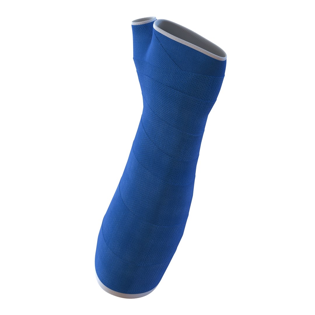 3d blue fiberglass cast arm
