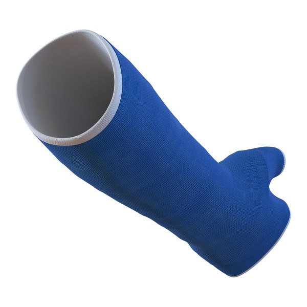 3d blue fiberglass cast arm