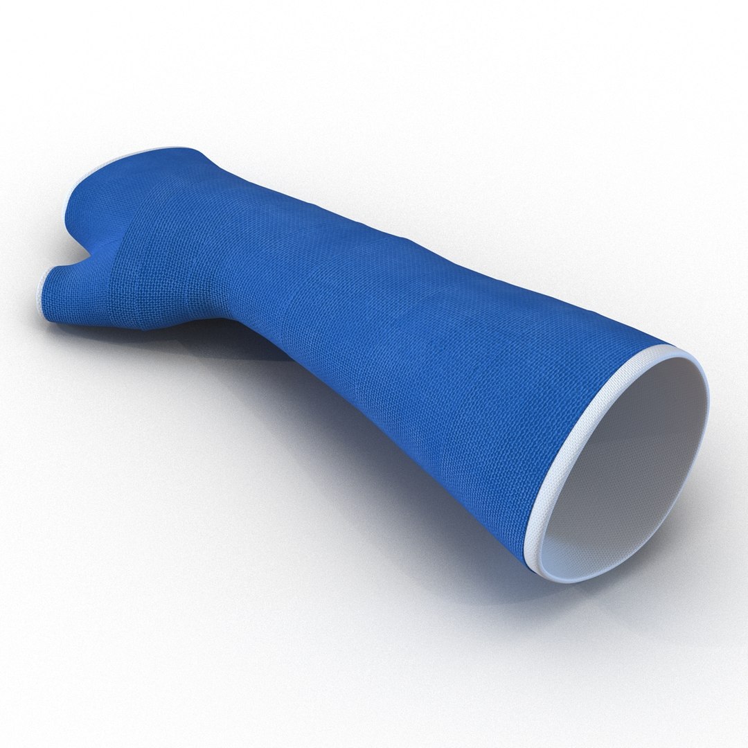 3d blue fiberglass cast arm