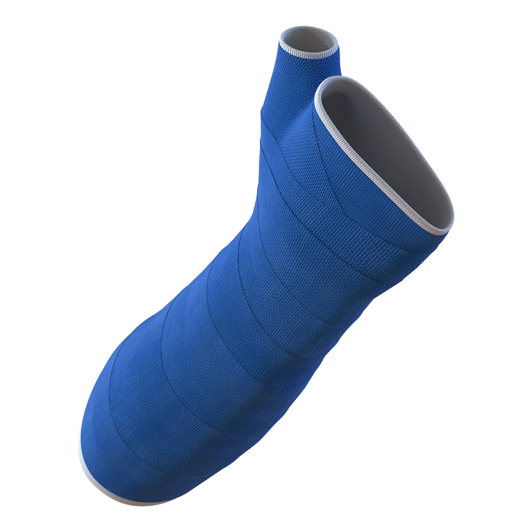 3d blue fiberglass cast arm