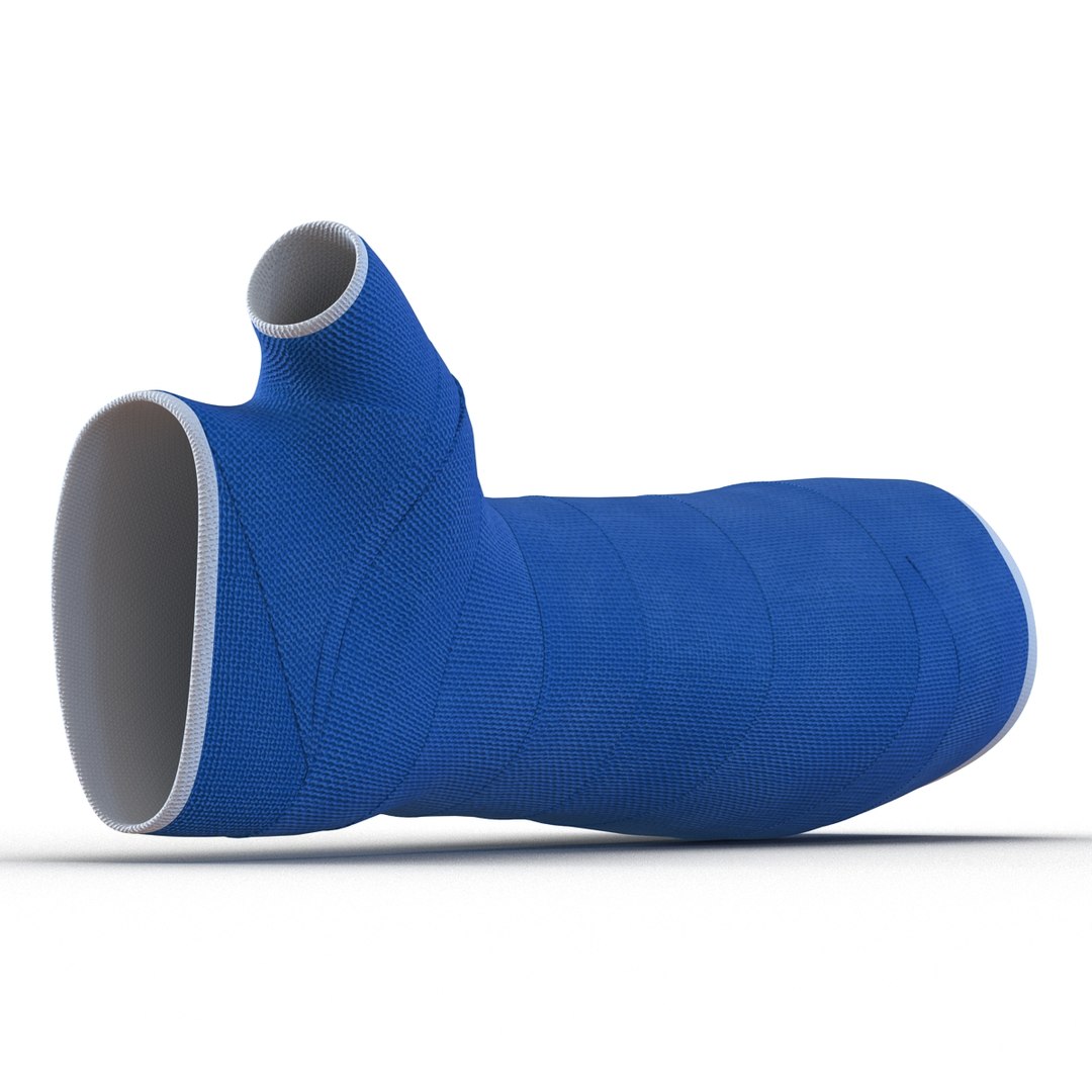 3d blue fiberglass cast arm