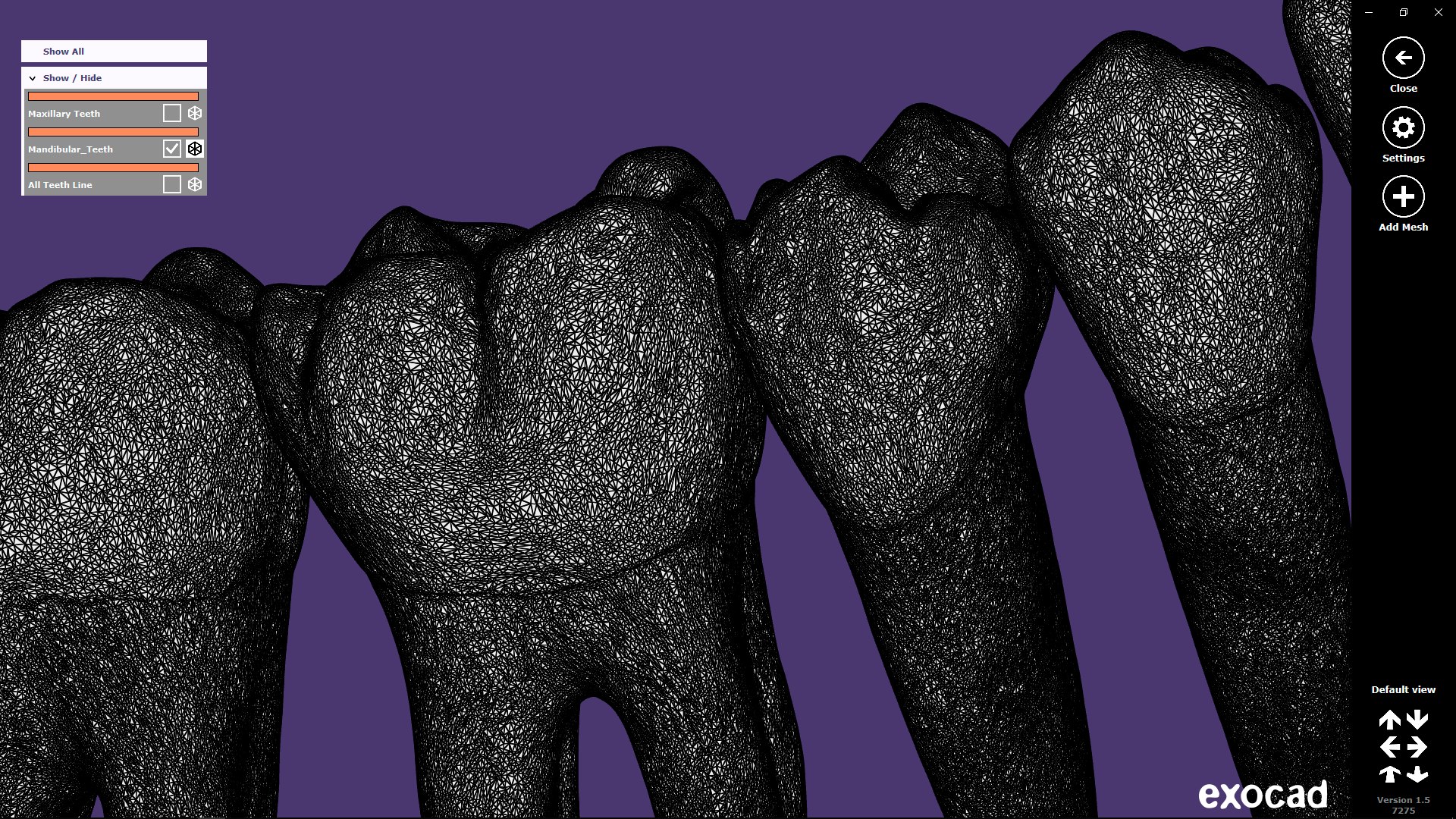 Teeth 3D Model - TurboSquid 1722346