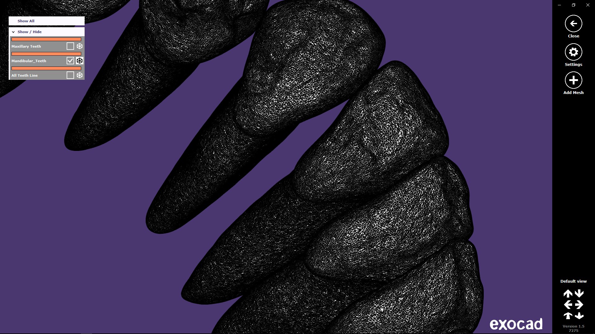 Teeth 3D model - TurboSquid 1722346