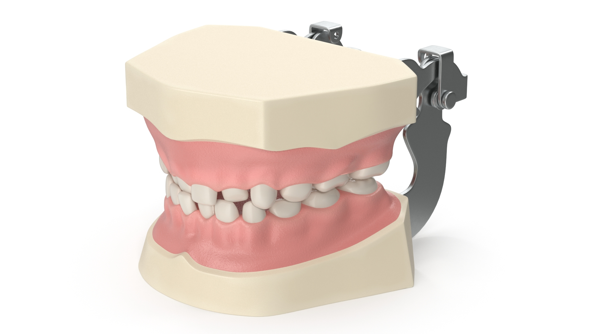 3D Dental Anatomy Model Simulation With Removable Crossbite Teeth Model ...