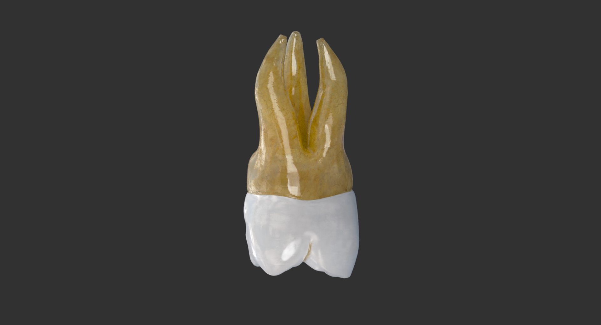 Upper Molar 3D - TurboSquid 1249395