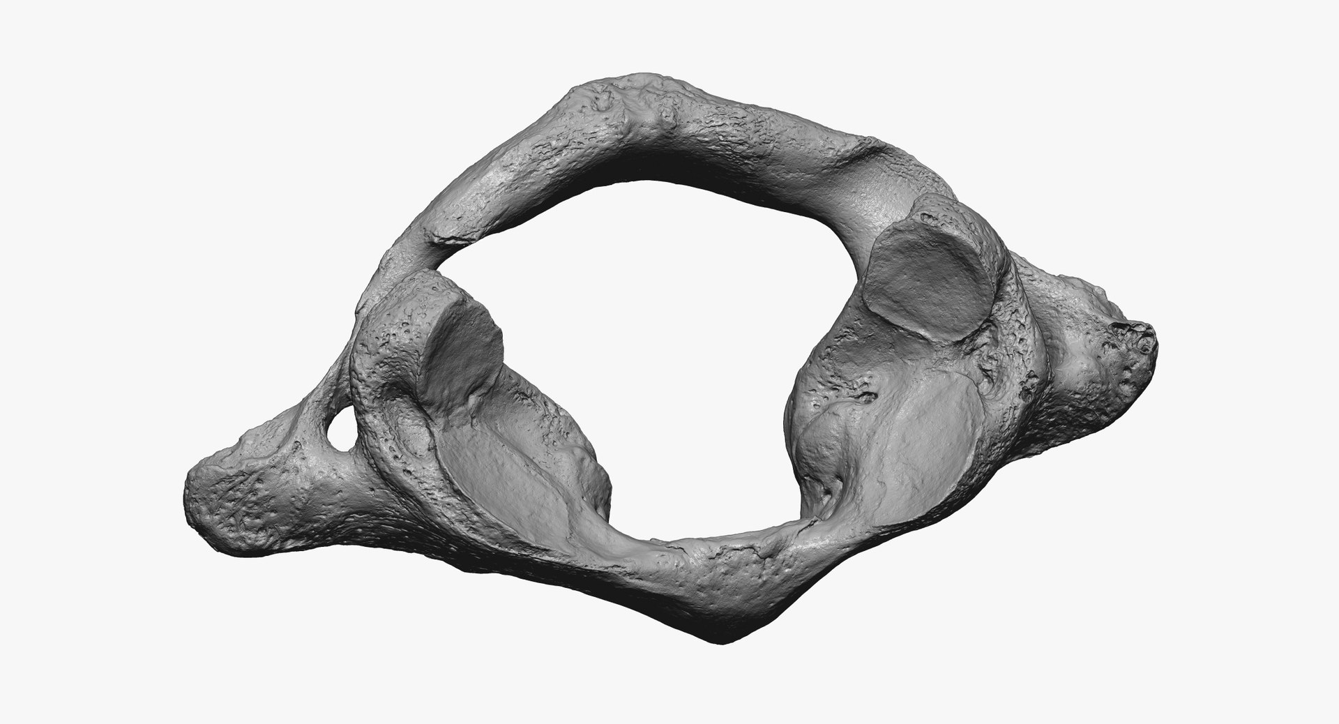 3D Model Cervical Vertebrae C1 Atlas - TurboSquid 1533800