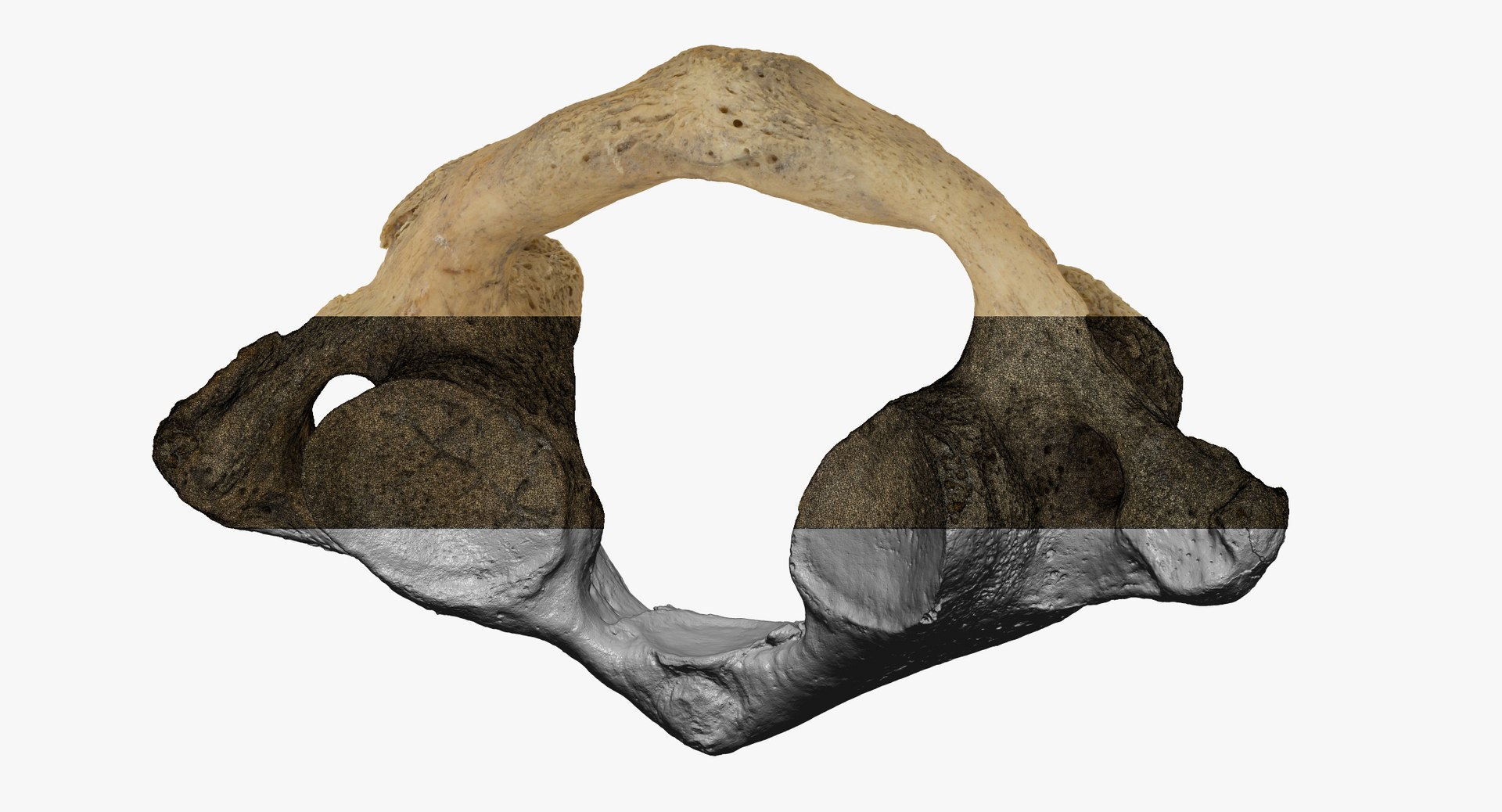 3D Model Cervical Vertebrae C1 Atlas - TurboSquid 1533800