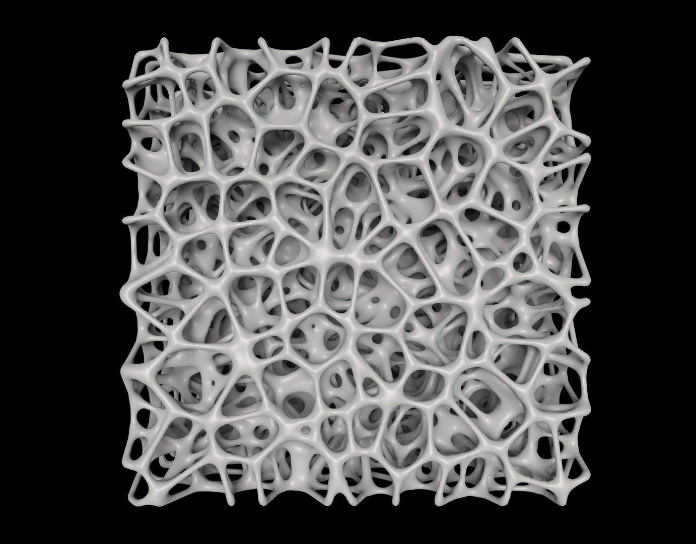 Bone Structure Osteoporosis 3D Model - TurboSquid 1174700