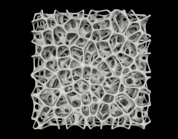 modelo 3d Estructura ósea normal y osteoporosis. Estructura ósea ...