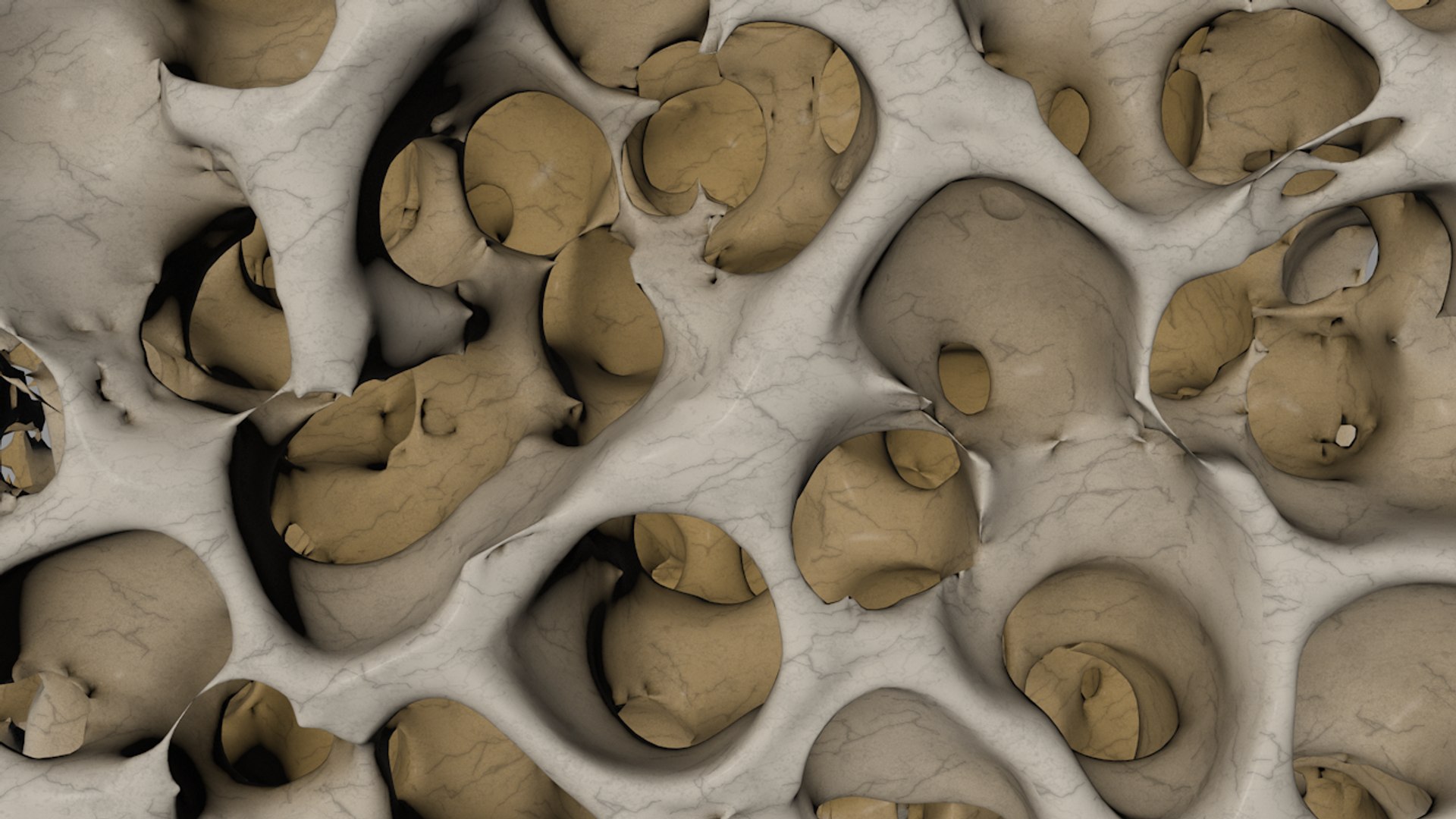 Bone structure osteoporosis 3D model - TurboSquid 1174700