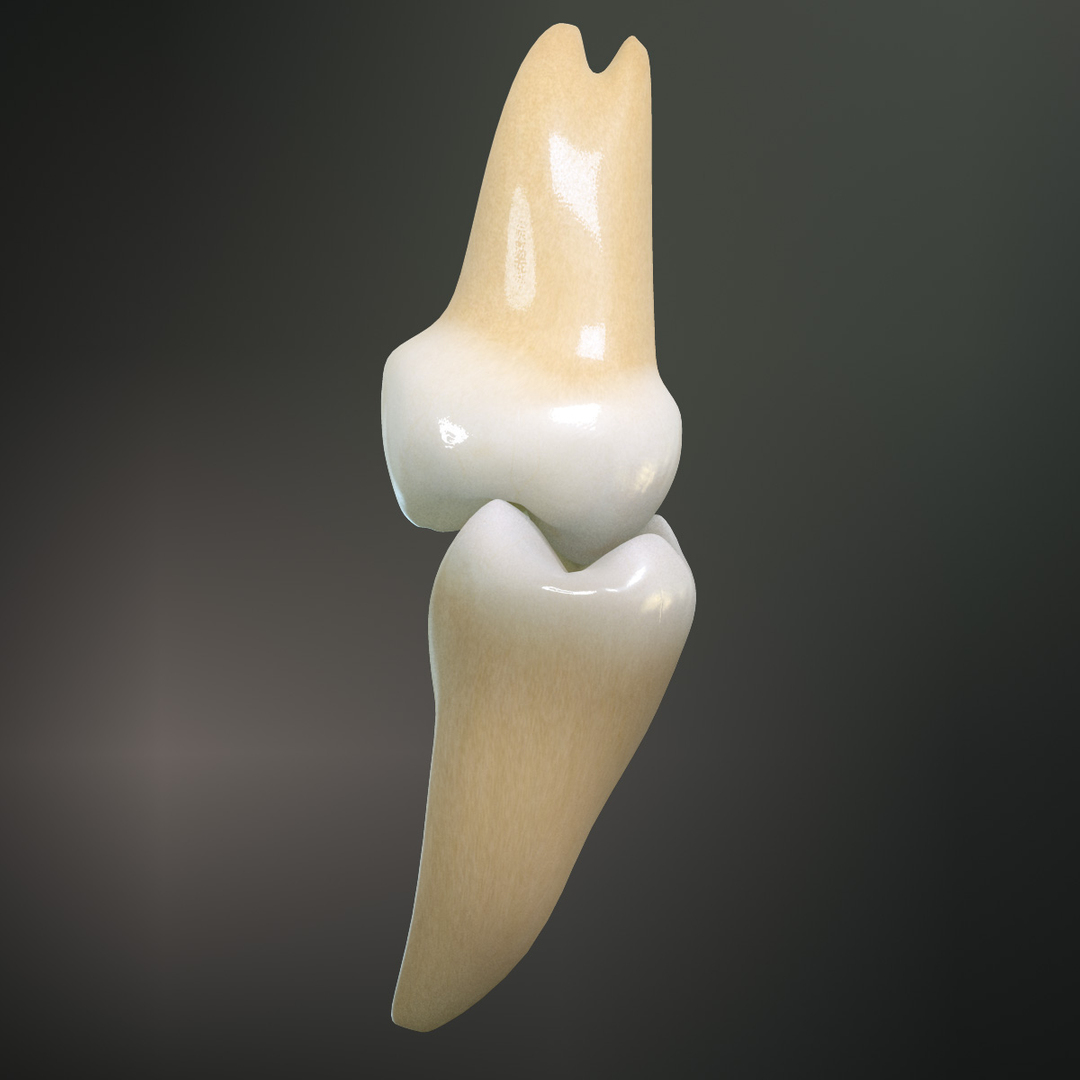 Max Teeth Molars Wisdoms