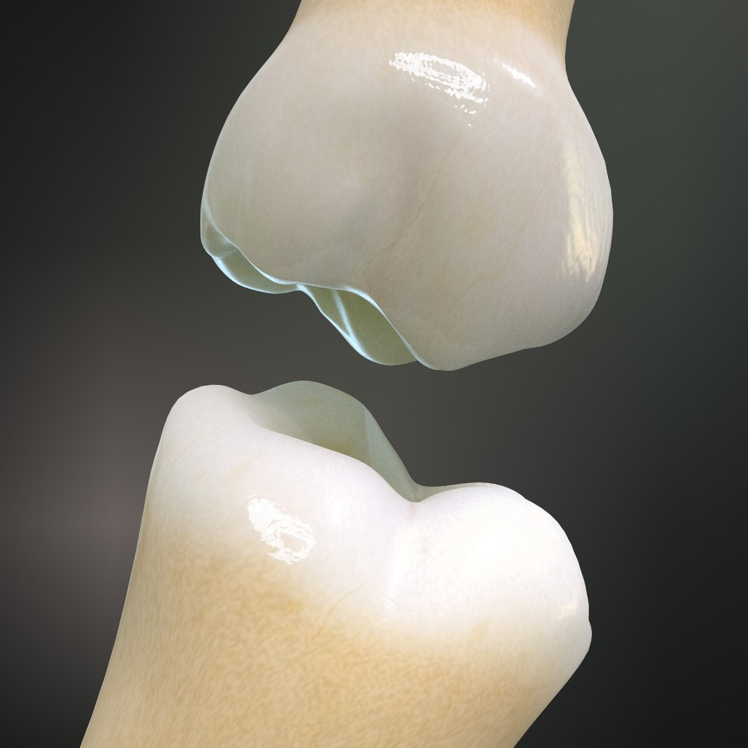 Max Teeth Molars Wisdoms