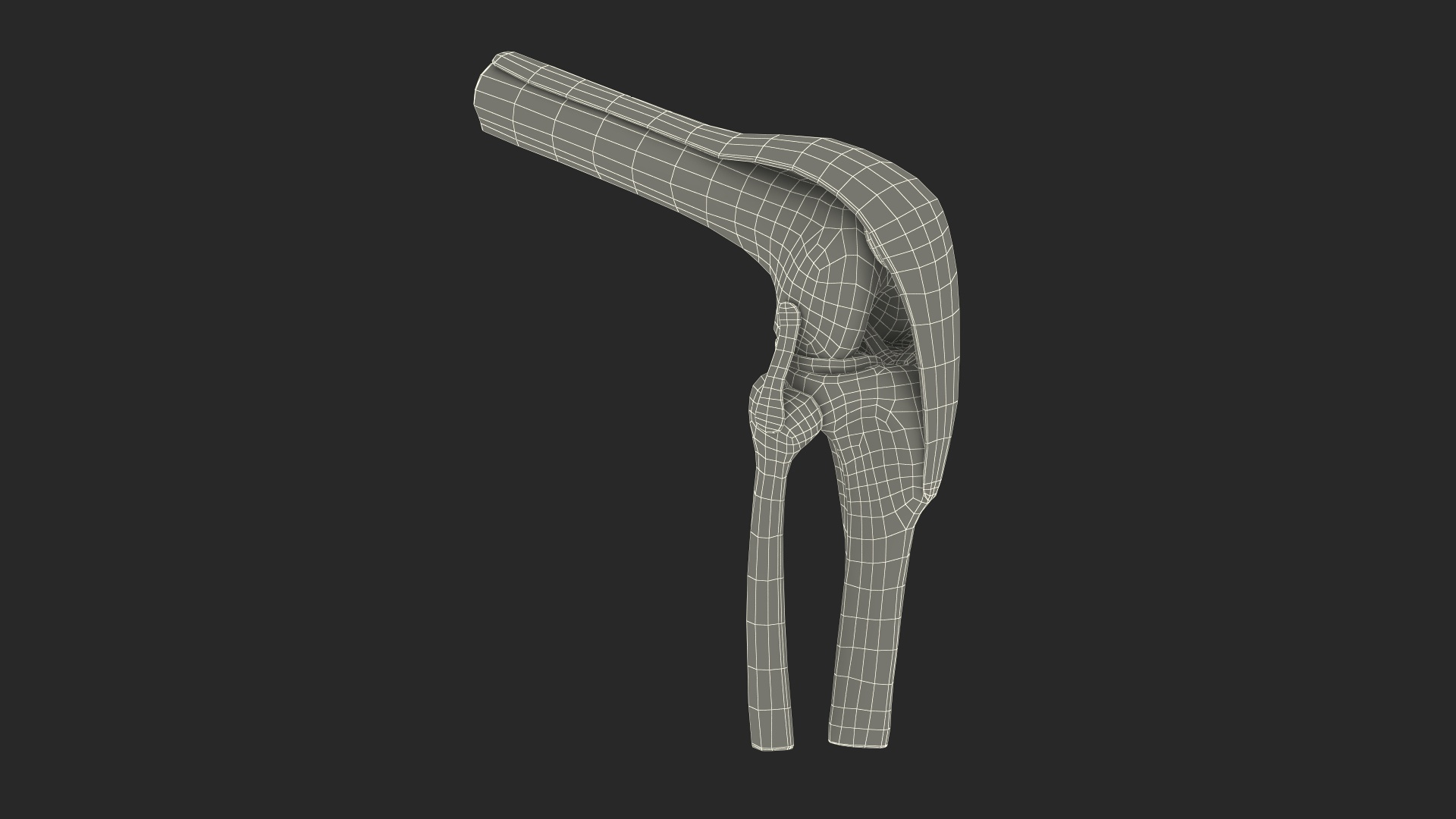 3D Knee Joint Model Bent State Model - TurboSquid 2248580