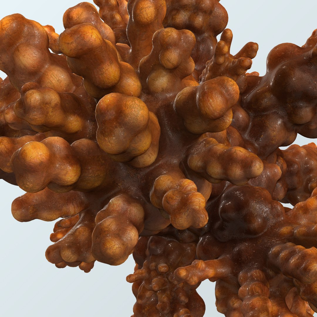 Realistic Kidney Stone 3D Model - TurboSquid 1208489