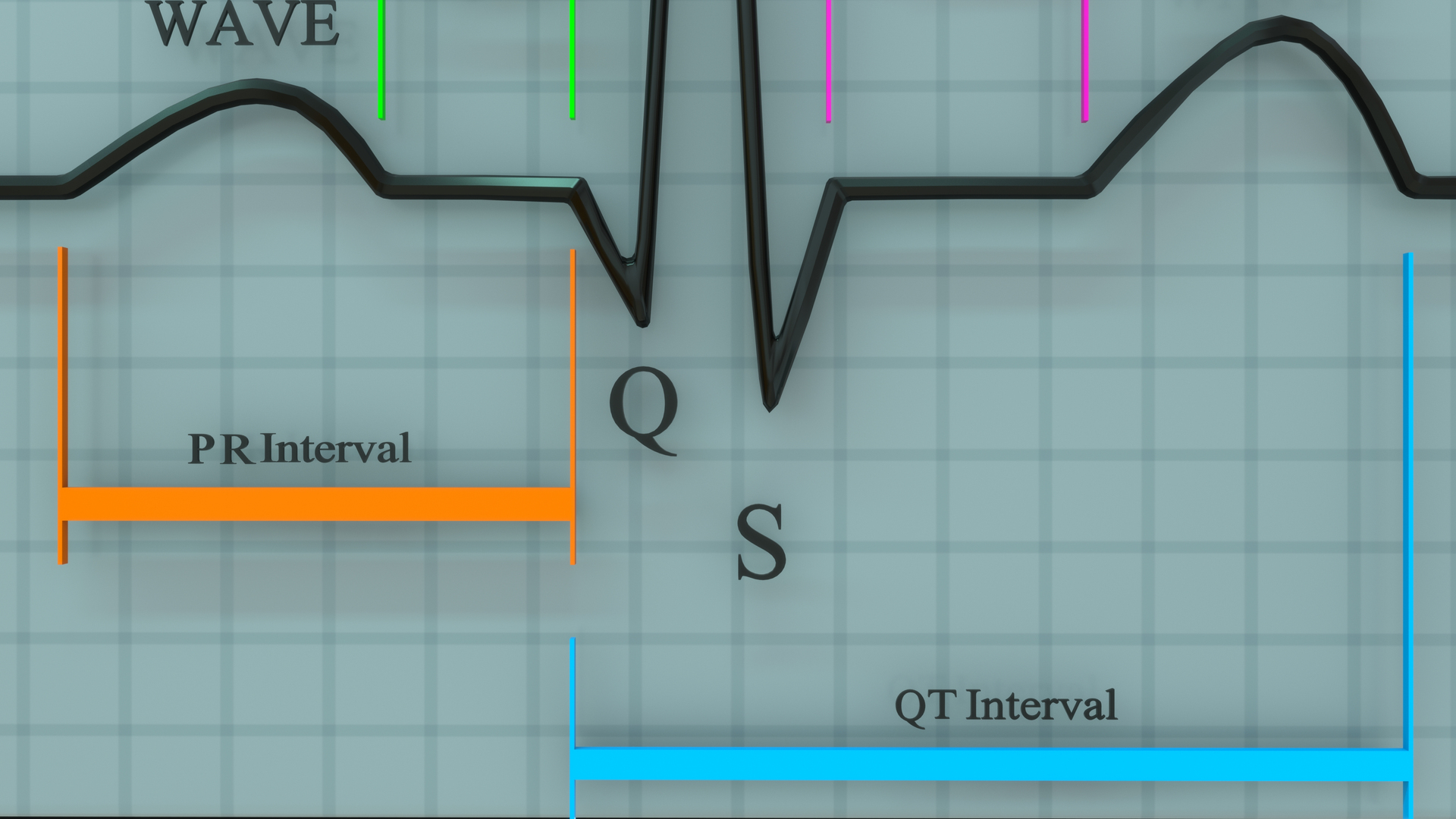 modelo 3d gráfico de ecg - TurboSquid 2190095