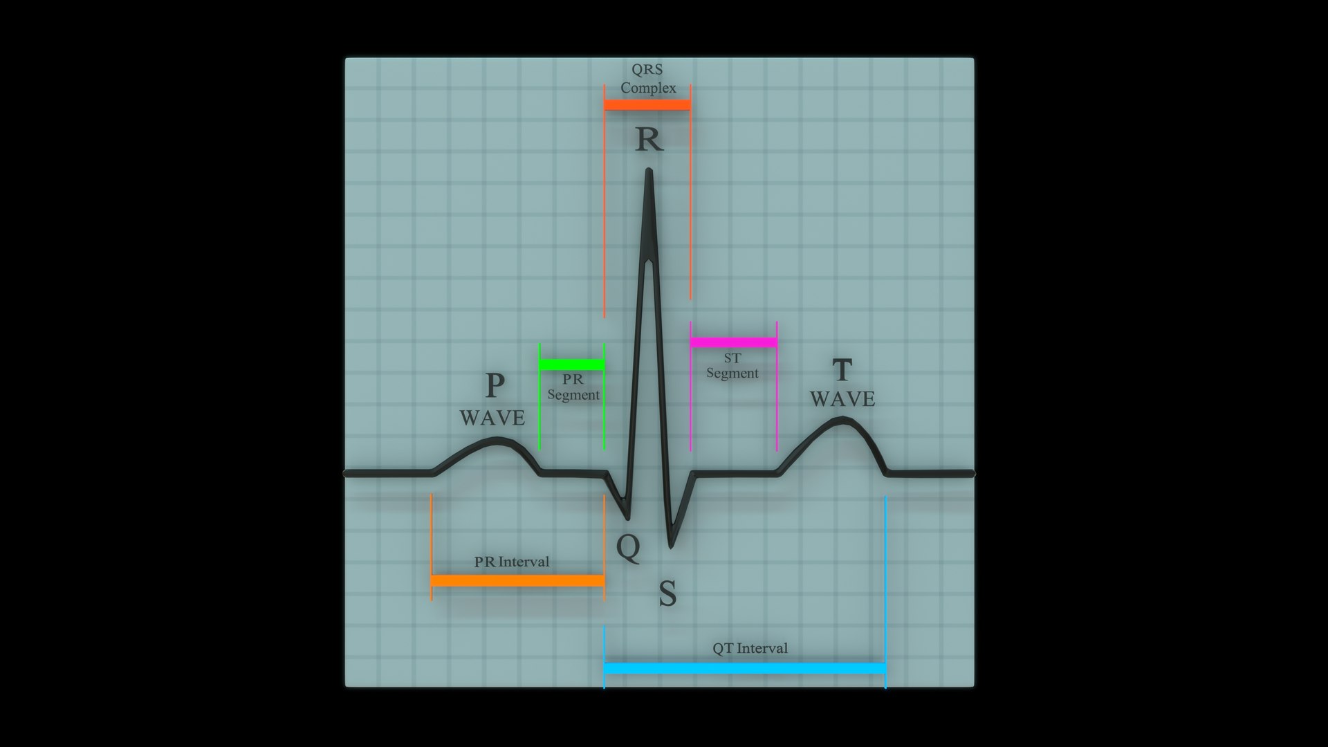 3D Ecg Graph Model - TurboSquid 2190095