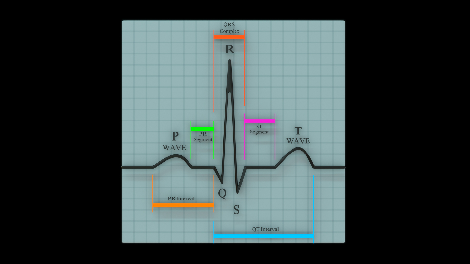 3D Ecg Graph Model - TurboSquid 2190095