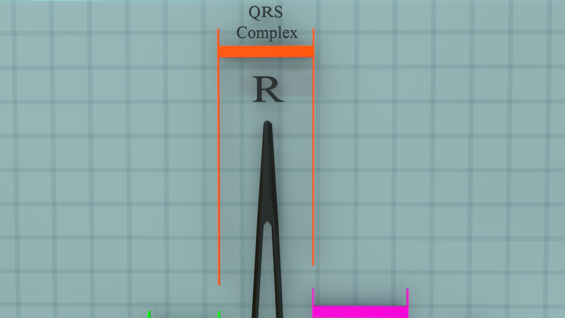 3D Ecg Graph Model - TurboSquid 2190095