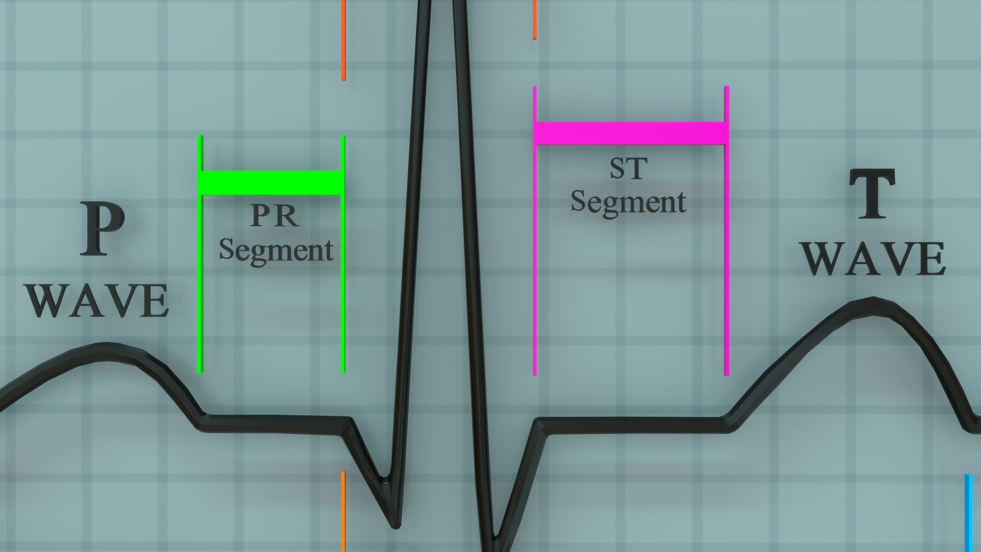 3D Ecg Graph Model - TurboSquid 2190095