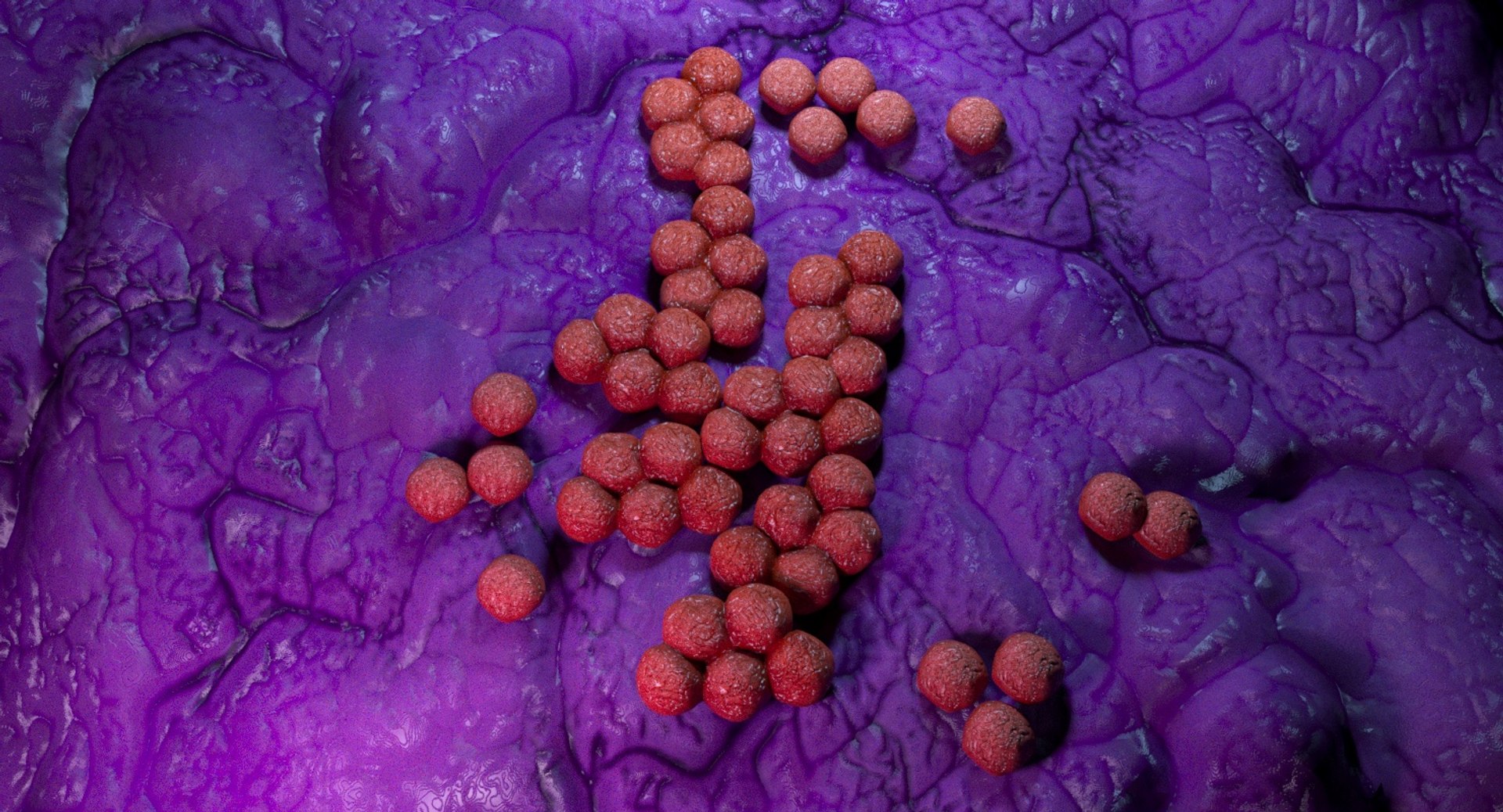 Mrsa Model - TurboSquid 1321228