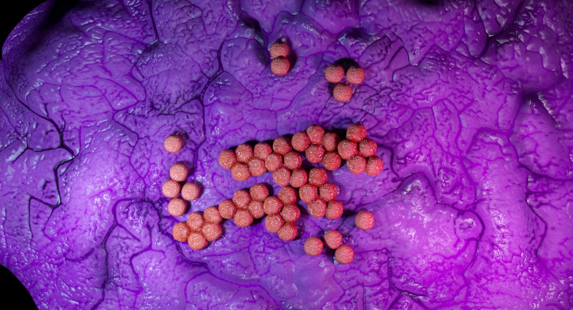 Mrsa Model - TurboSquid 1321228