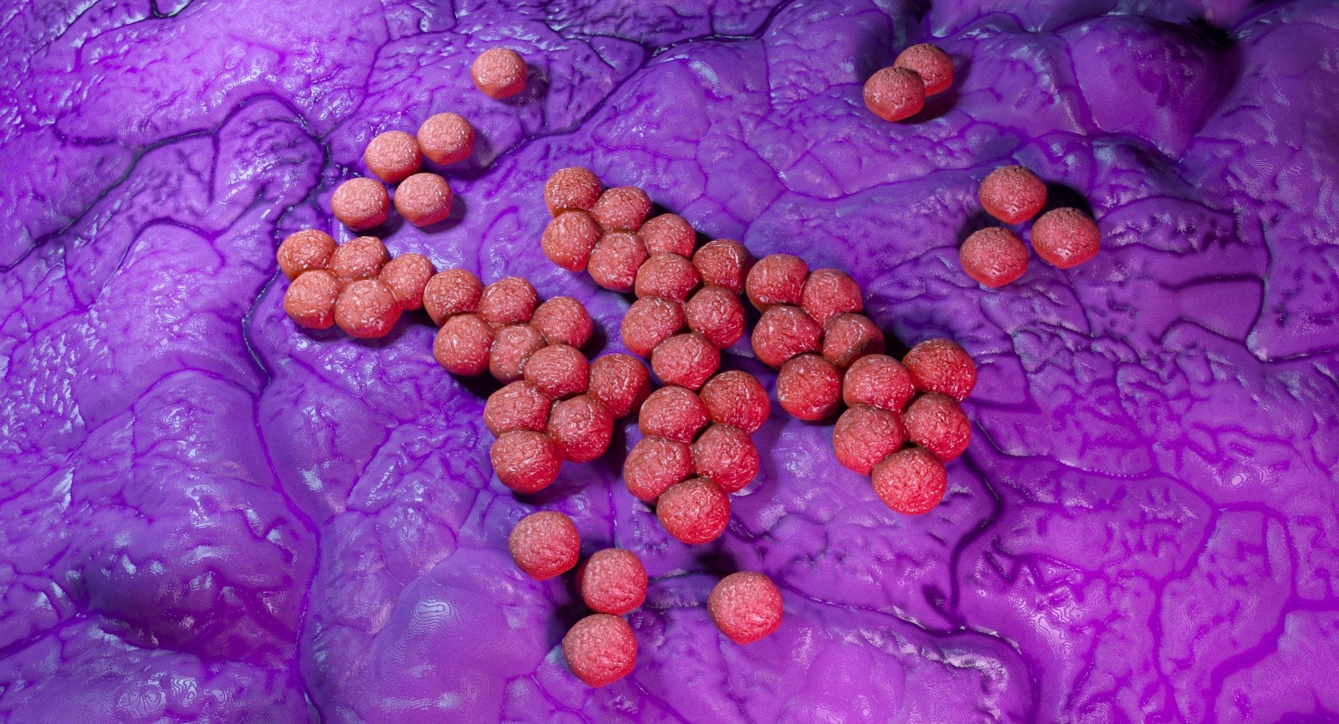 Mrsa Model - TurboSquid 1321228