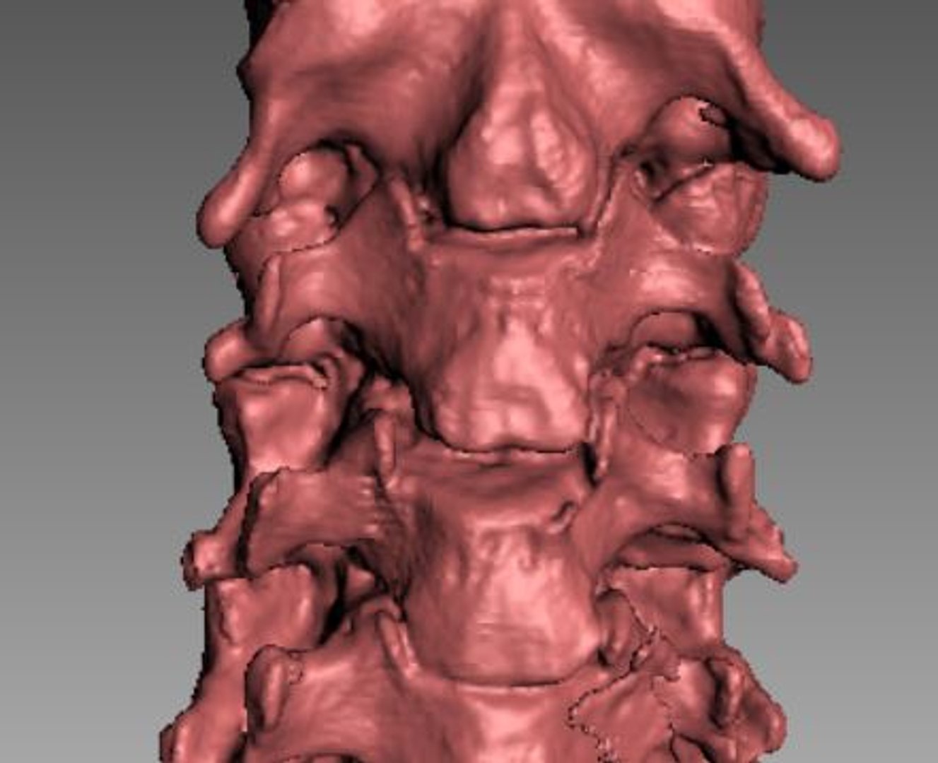 3D Human Spine Model - TurboSquid 1335397