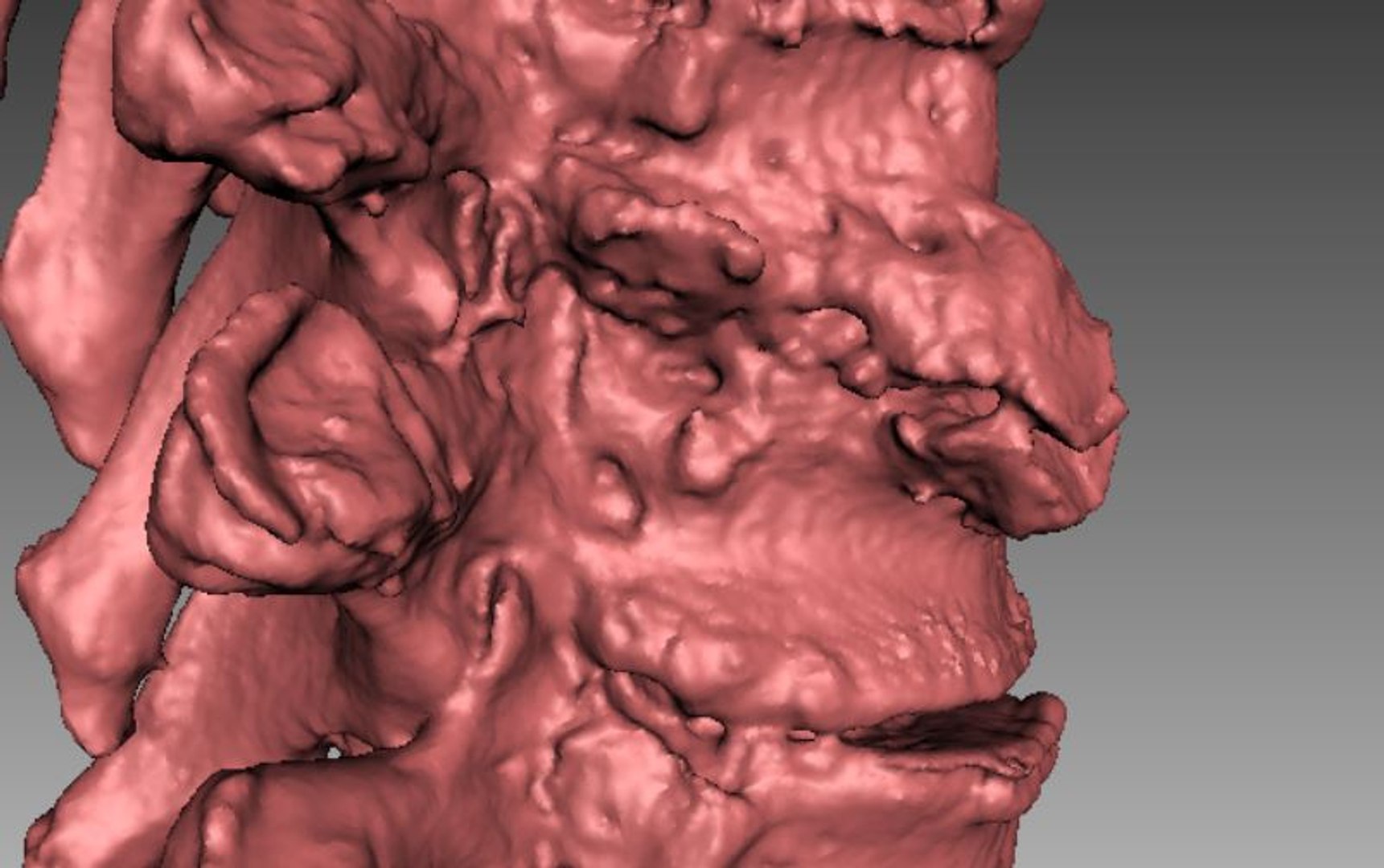 3D Human Spine Model - TurboSquid 1335397