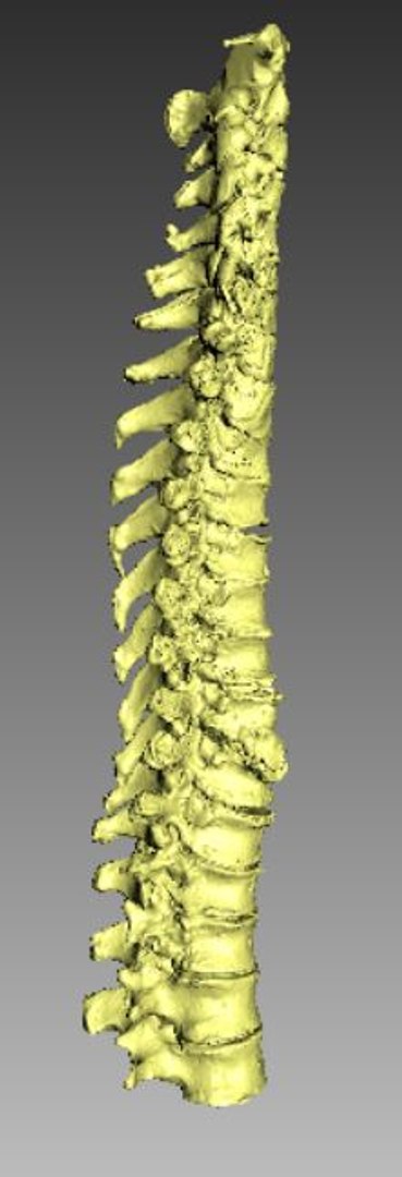 3D Human Spine Model - TurboSquid 1335397