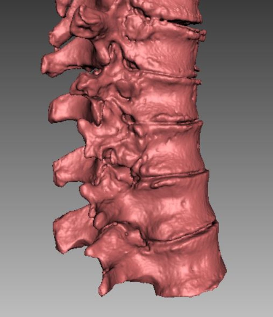 3D Human Spine Model - TurboSquid 1335397