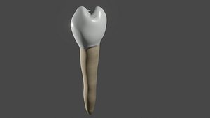 STL Tooth Models | TurboSquid