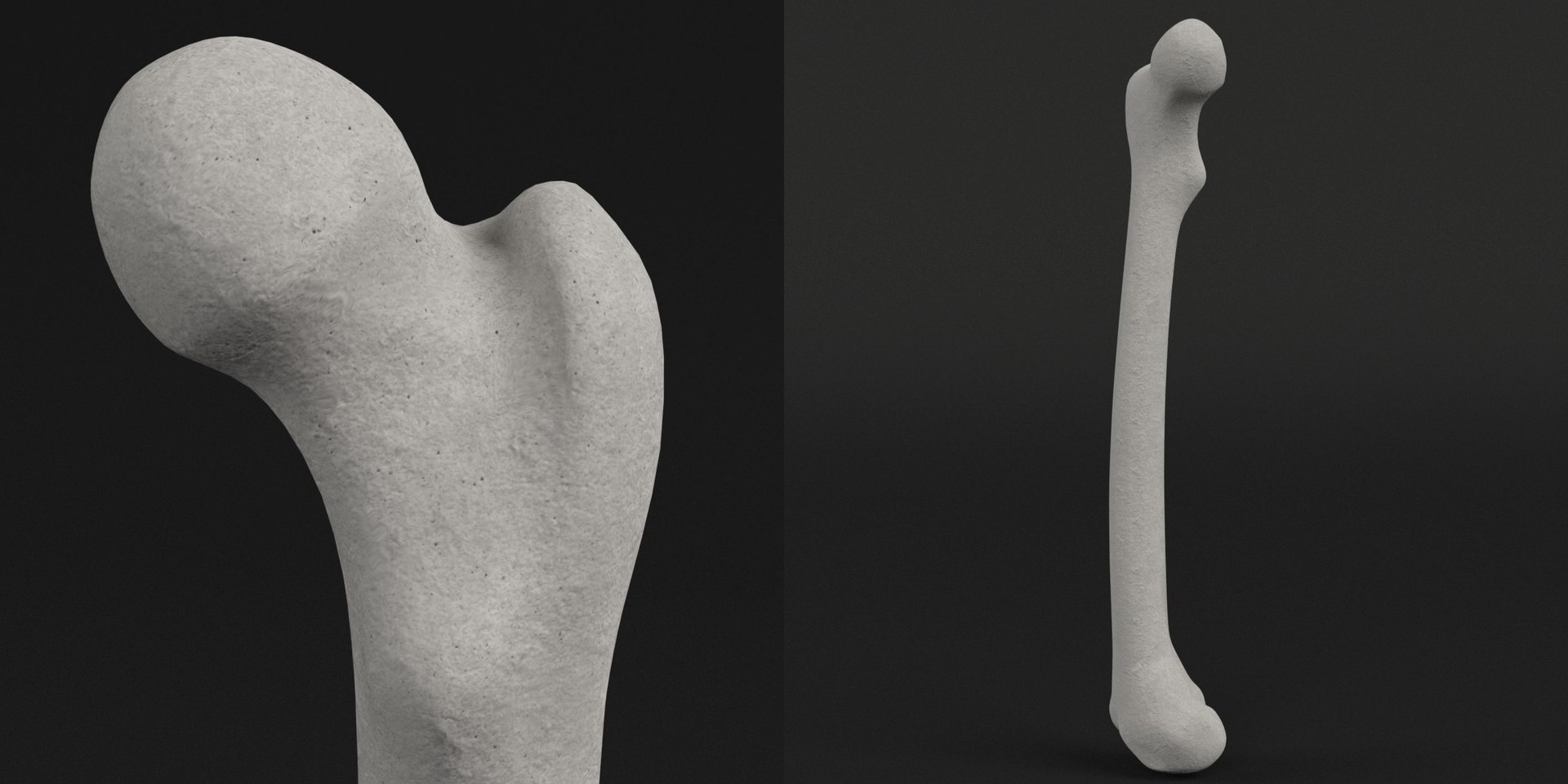 Human Femur 2 3D Model - TurboSquid 1174531