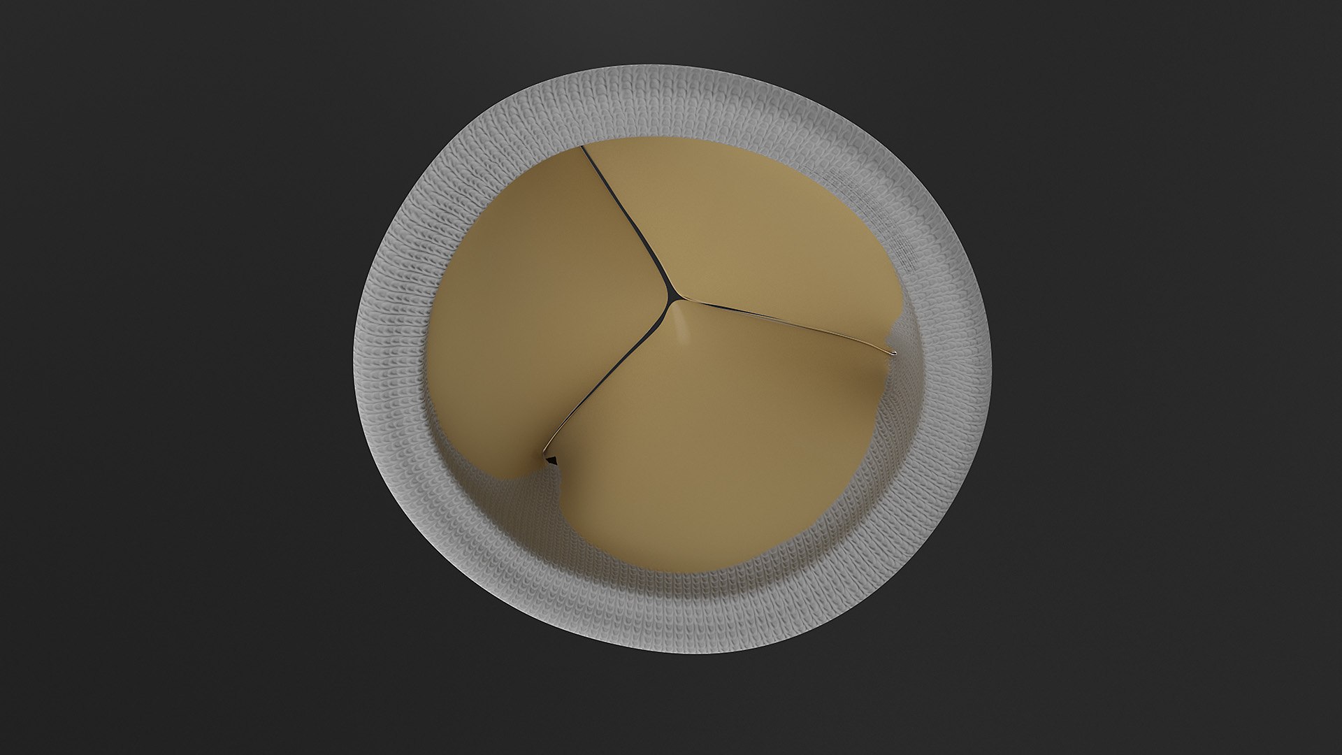 3D Stented Heart Valve - TurboSquid 1965639