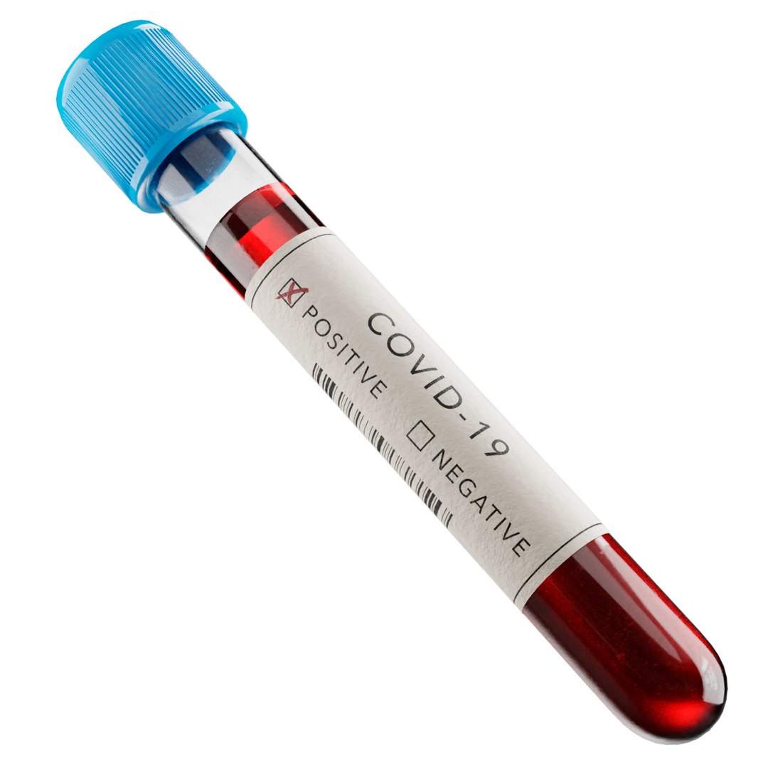 Coronavirus Covid-19 Test Tube 3D Model - TurboSquid 1540217